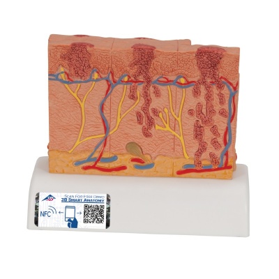 3B Scientific Magnified Skin Cancer Model | Health and Care